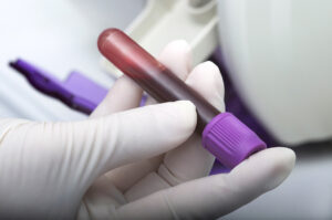 What Is Exsanguination? - Phoenix, AZ - KRLG Injury Lawyers